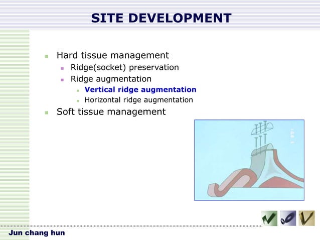 Vertical Ridge Augmentation.ppt