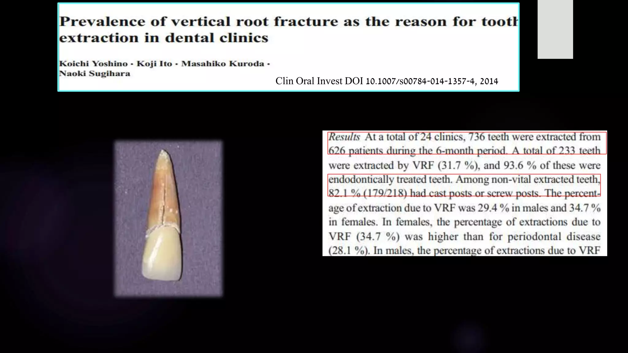 Vertical root fracture | PPTX