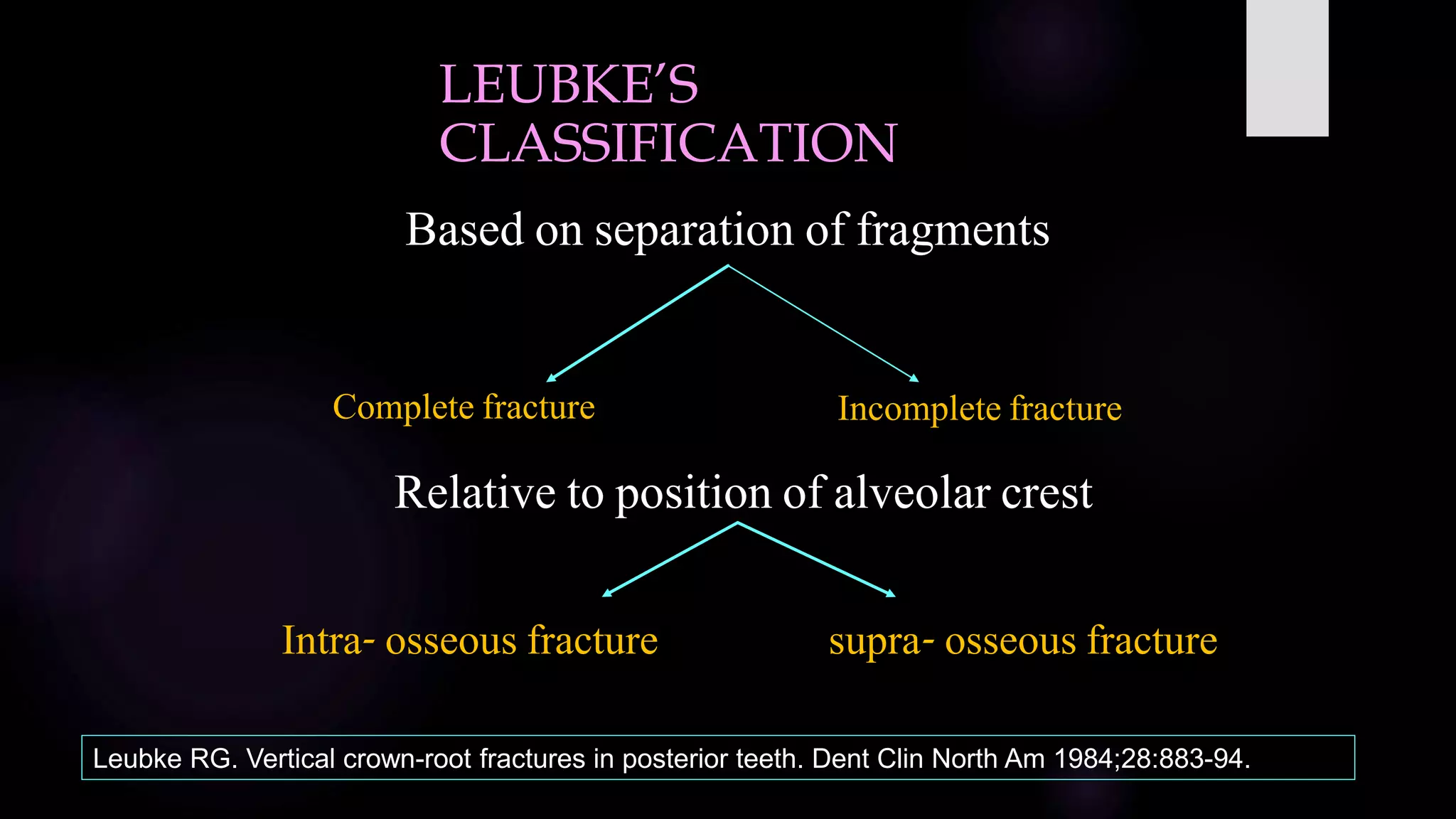Vertical root fracture | PPTX