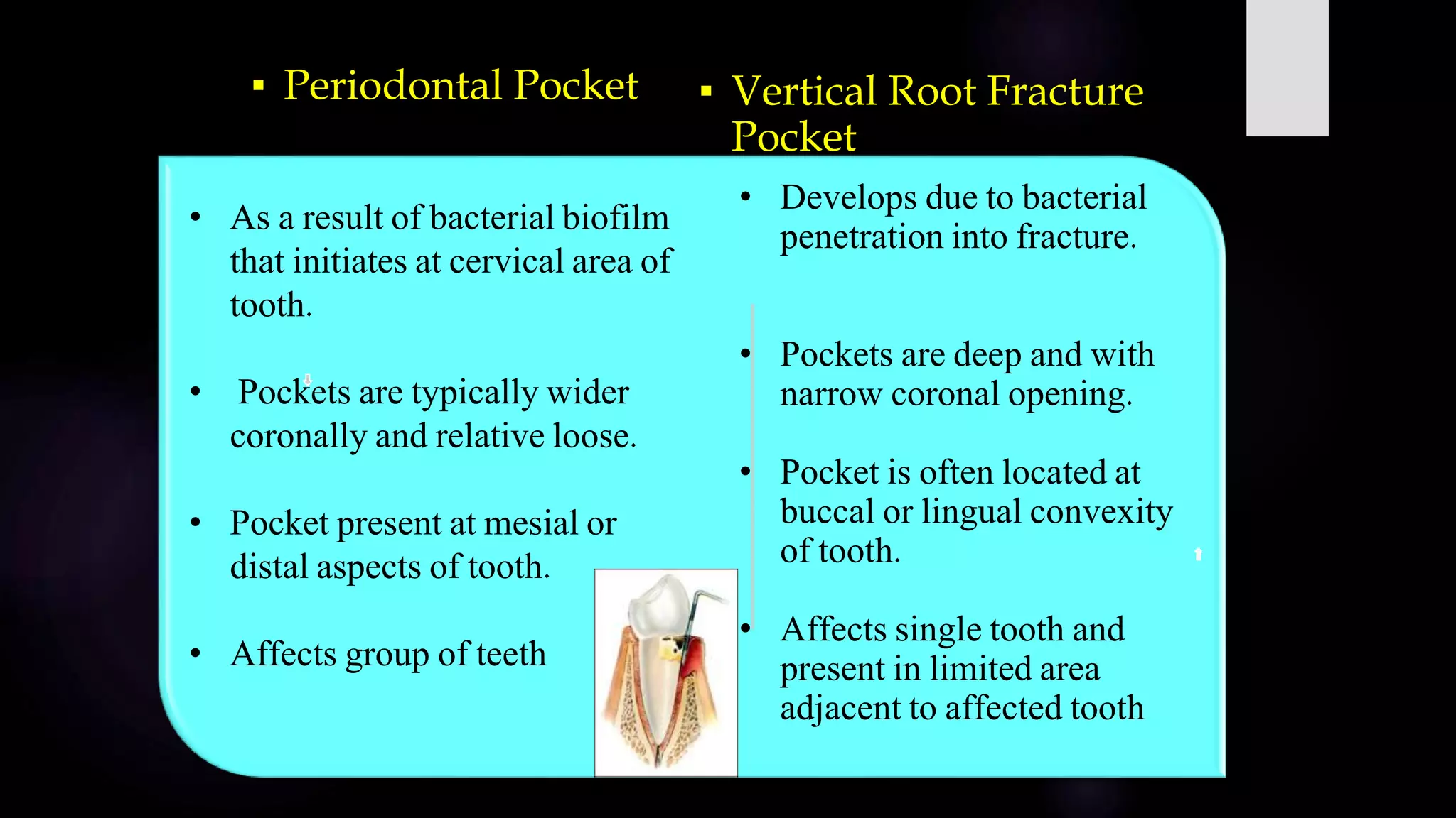 Vertical root fracture | PPTX