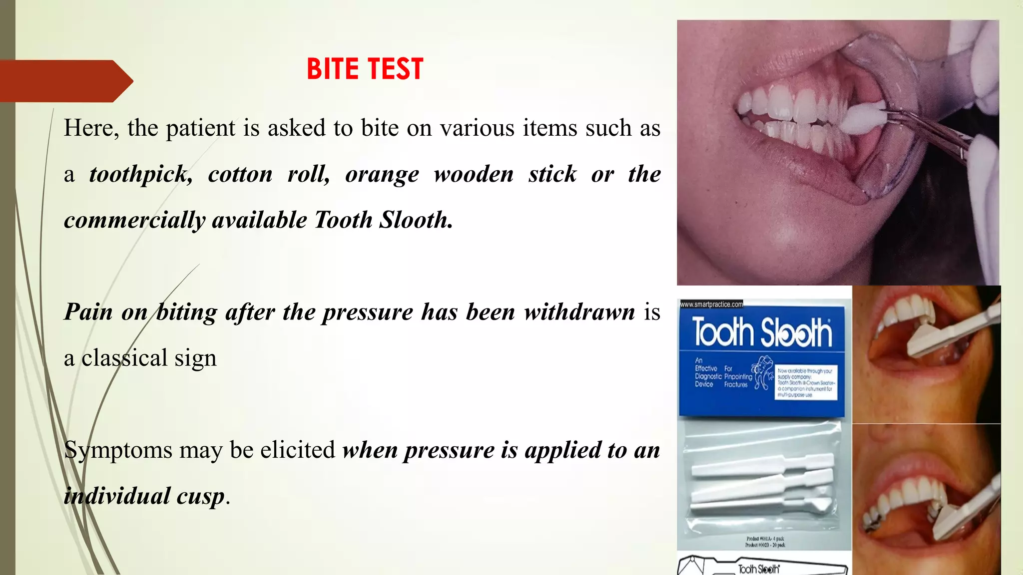 VERTICAL ROOT FRACTURE !.pdf