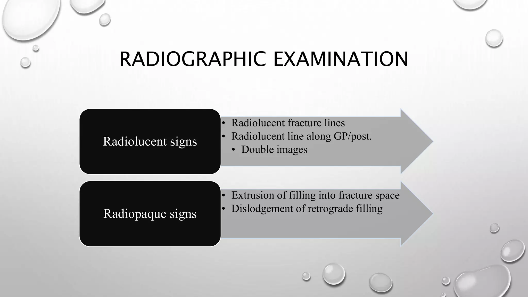 Vertical root fractures | PPTX