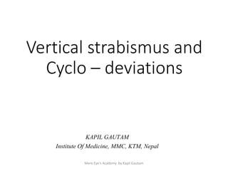 Vertical Strabismus and Cyclo-deviations | PDF