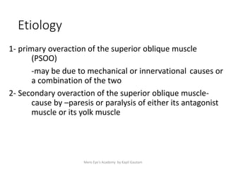 Vertical Strabismus and Cyclo-deviations | PDF