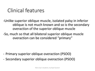 Vertical Strabismus and Cyclo-deviations | PDF