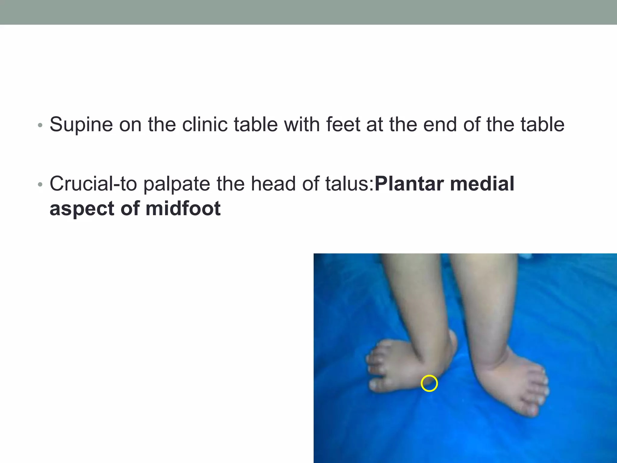 Vertical talus | PPTX