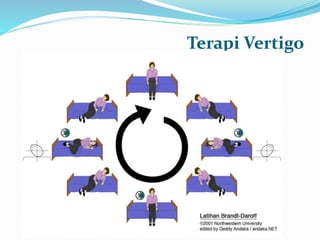 Vertigo | PPTX