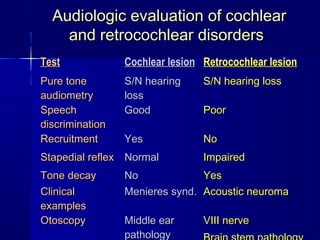 Approach to Vertigo | PPT