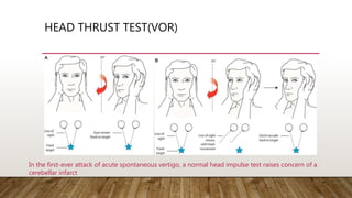 Approach to Vertigo | PPTX