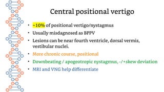 Vertigo - Diagnostic Approach | PDF