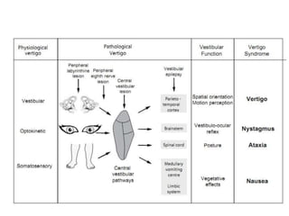 Vertigo.pptx