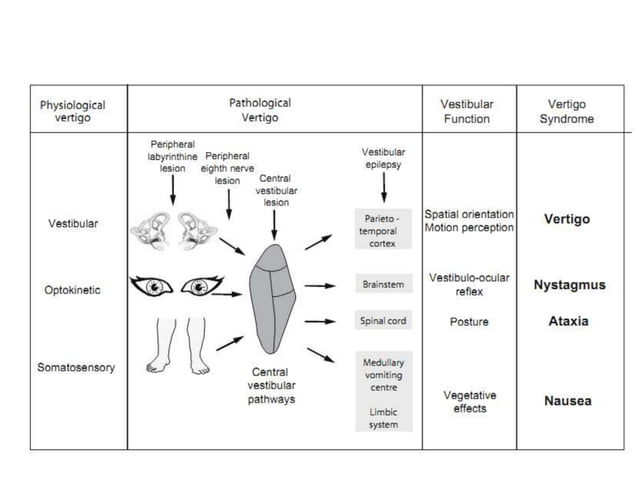 Vertigo.pptx | Brain and Nervous System Disorders | Diseases and Conditions
