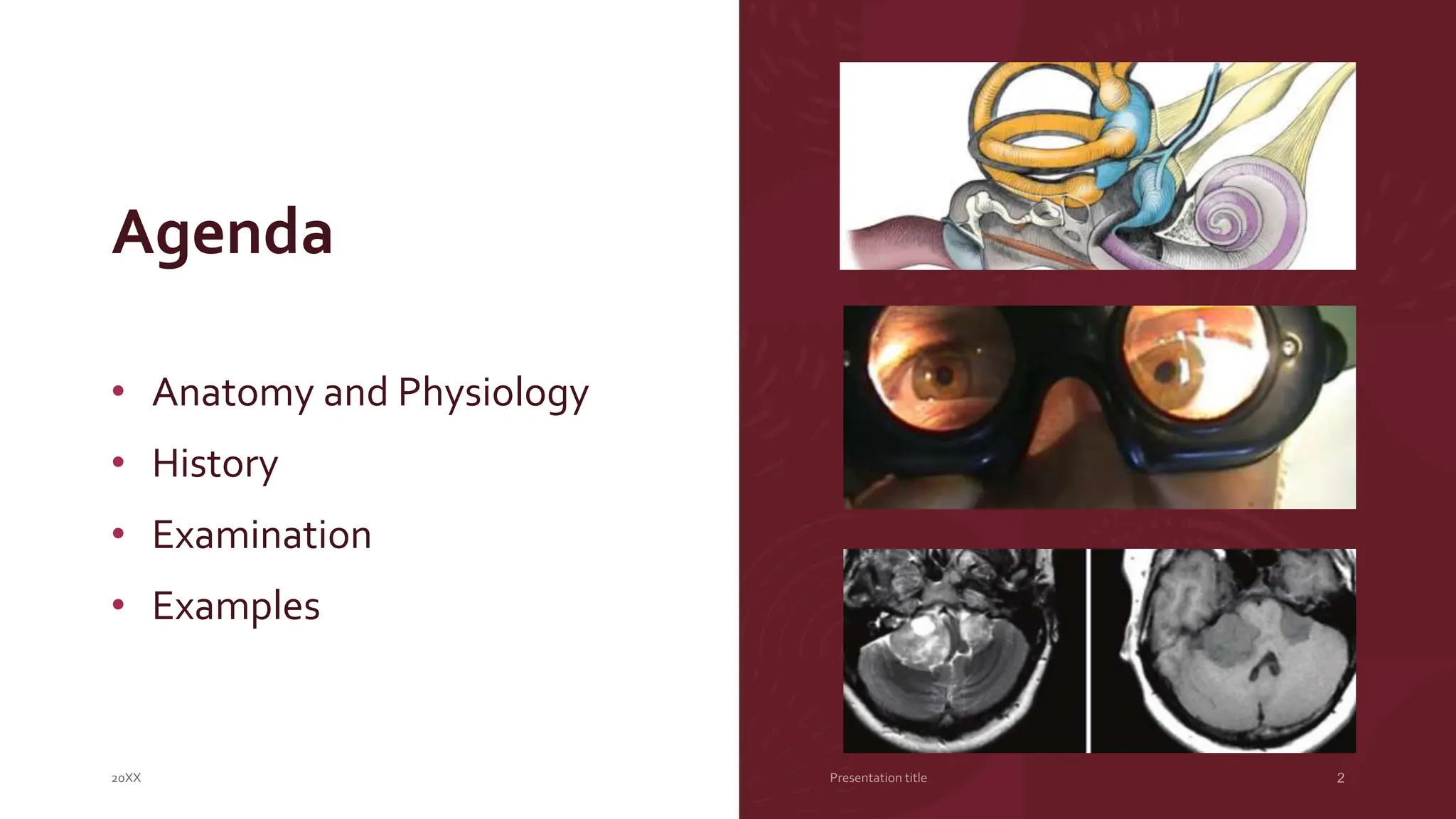 Vertigo and Nystagmus - Clinical approach.pptx