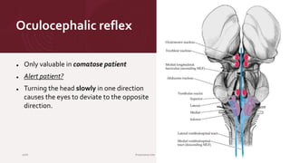 Vertigo and Nystagmus - Clinical approach.pptx