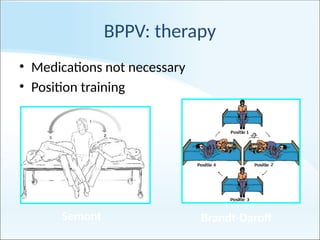 Vertigo diagnosis and management of vertigo | PPTX