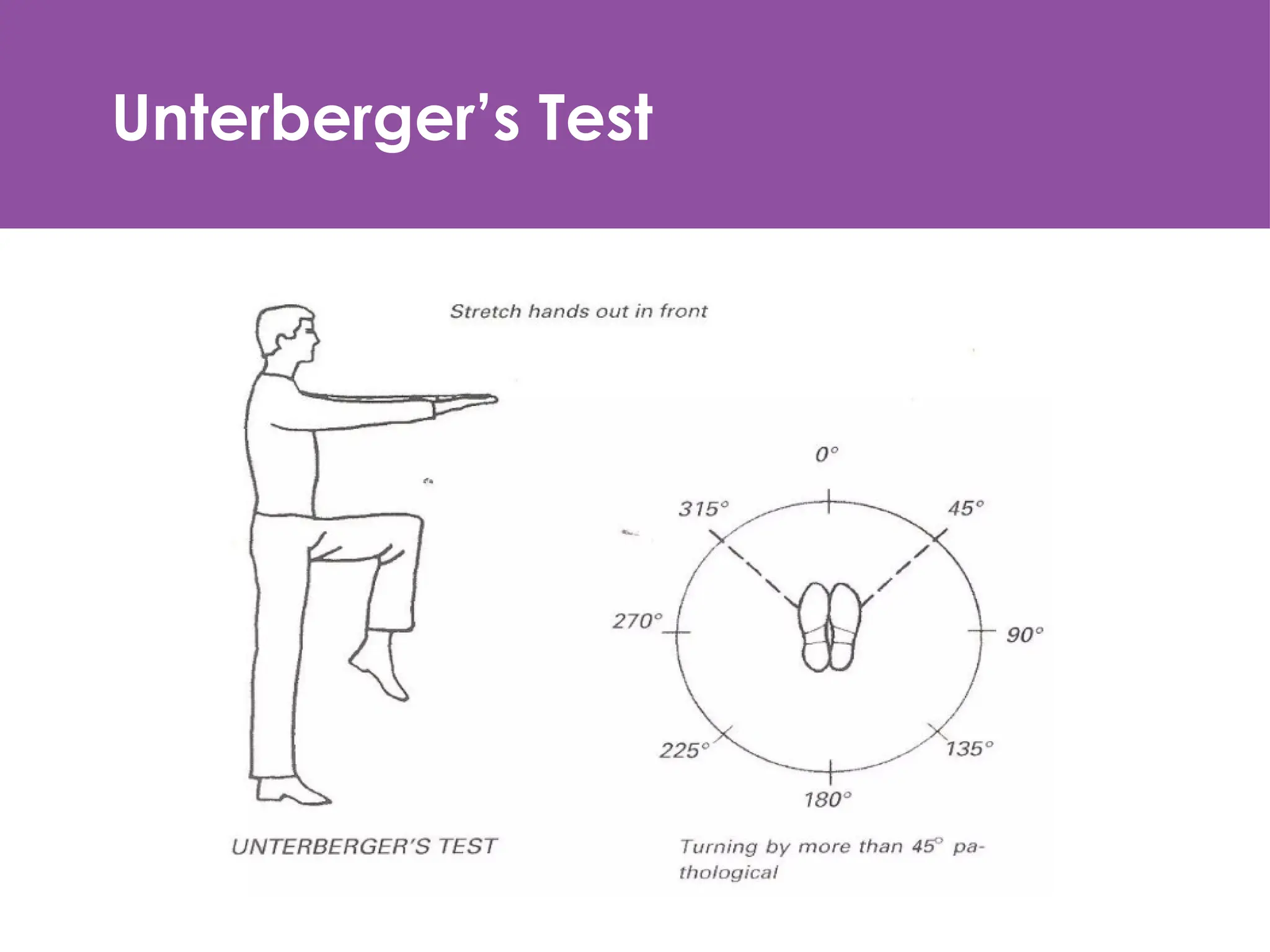 Vertigo and its Definition and Management.pptx