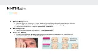 Vertigo: A Practical Approach | PPT