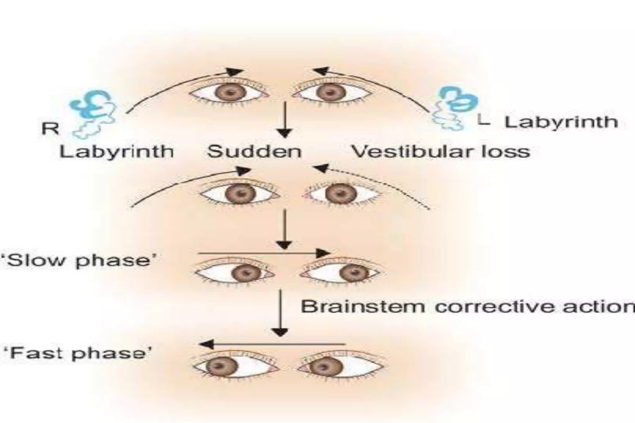Vertigo & Dizziness: Diagnosis, Management | PPT