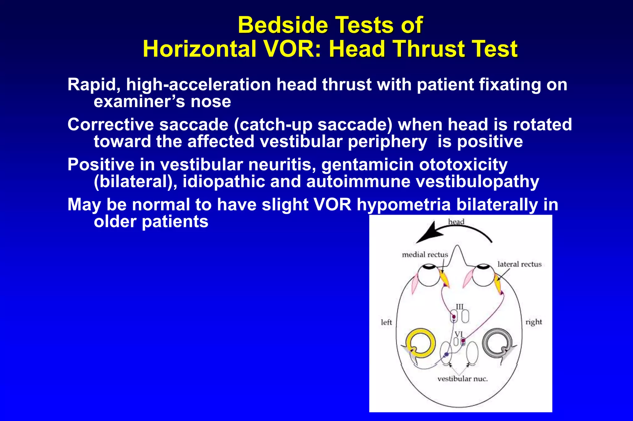 Vertigo & Dizziness: Diagnosis, Management | PPT