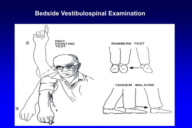 Vertigo & Dizziness: Diagnosis, Management | PPT | Ear, Nose and Throat ...