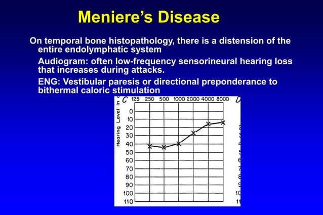 Vertigo & Dizziness: Diagnosis, Management | PPT | Ear, Nose and Throat ...