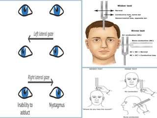 Vertigo & Dizzziness.pdf