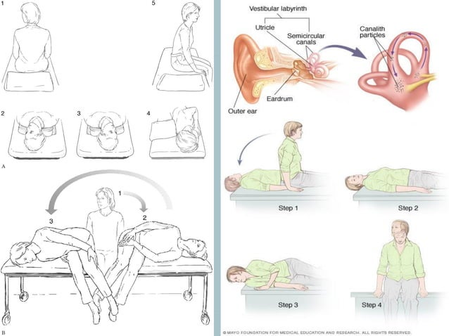 Vertigo & Dizzziness.pdf