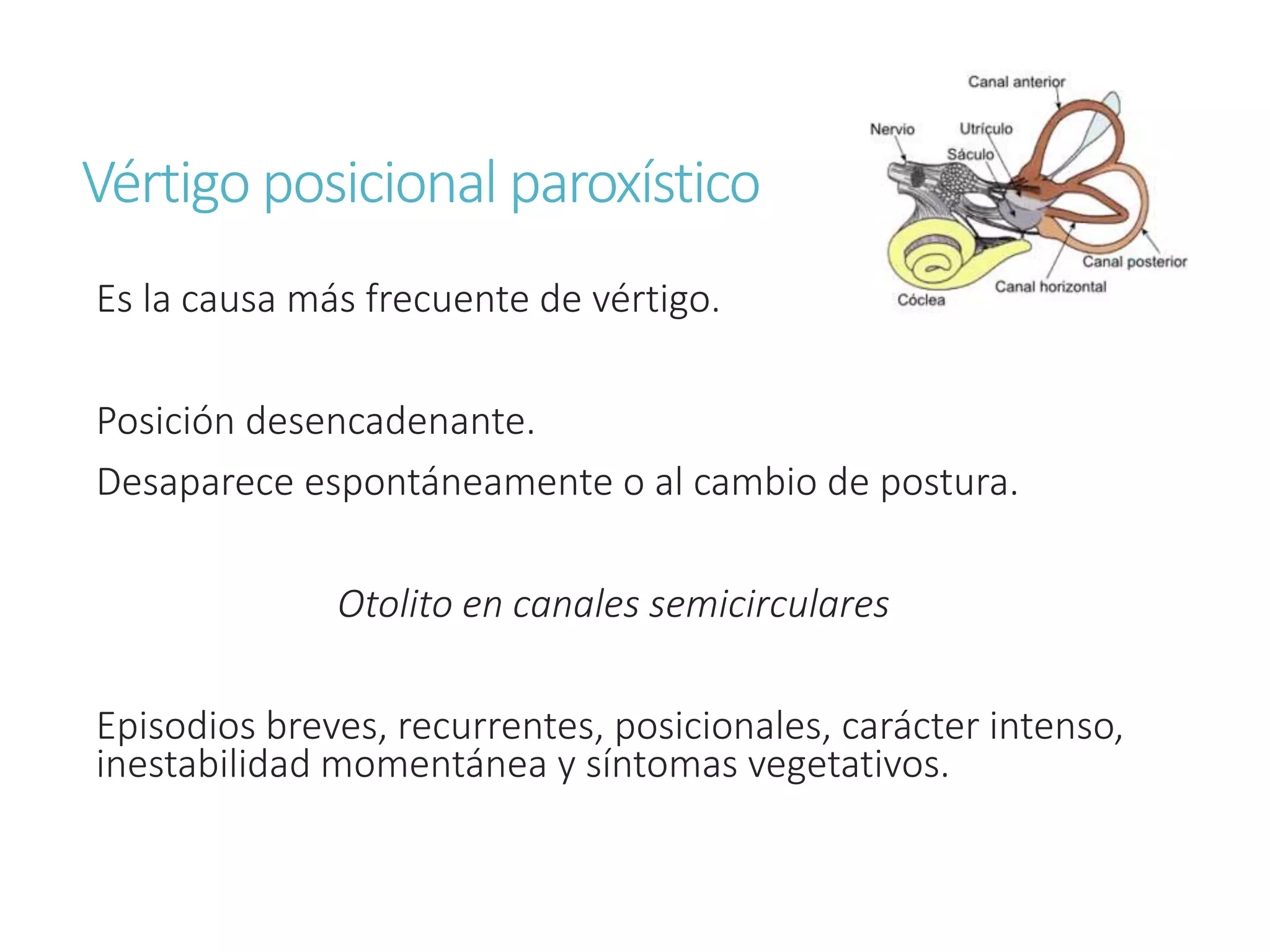 Vertigo posicional paroxistico | PPTX