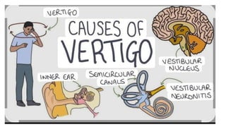 Vertigo ppt and it's complication treatment and management | PPTX