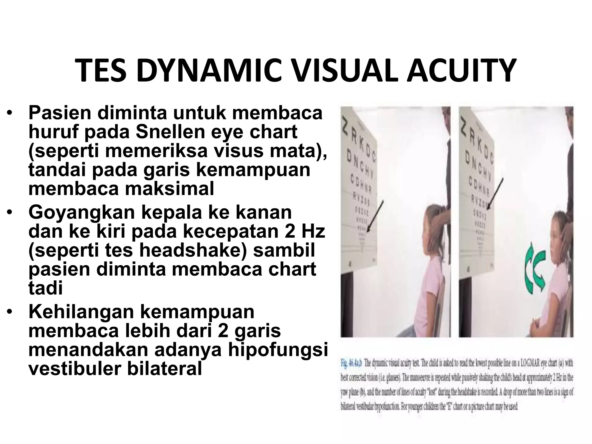 Vertigo Work up & management pptx.pptx