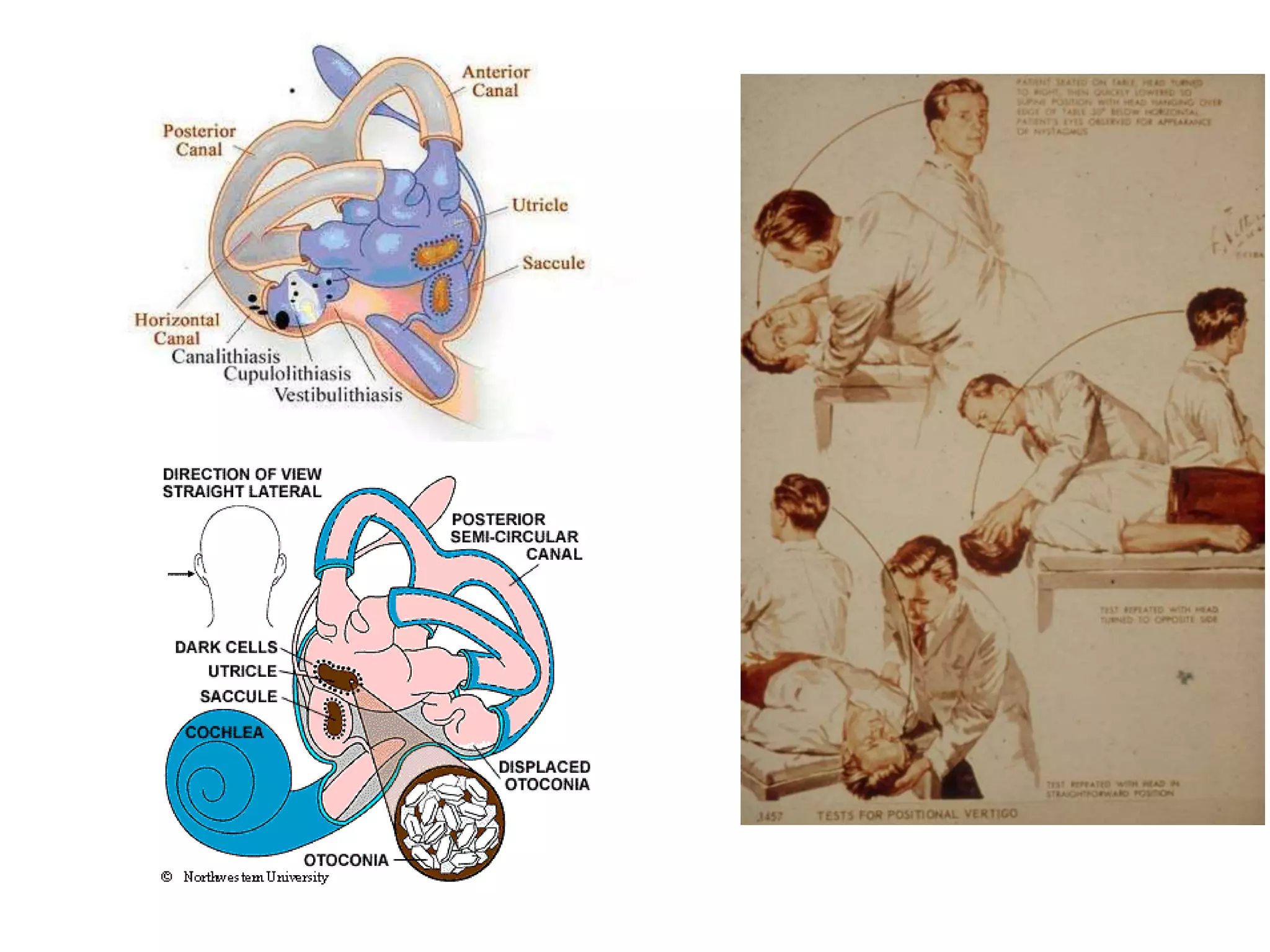 Vertigo Work up & management pptx.pptx
