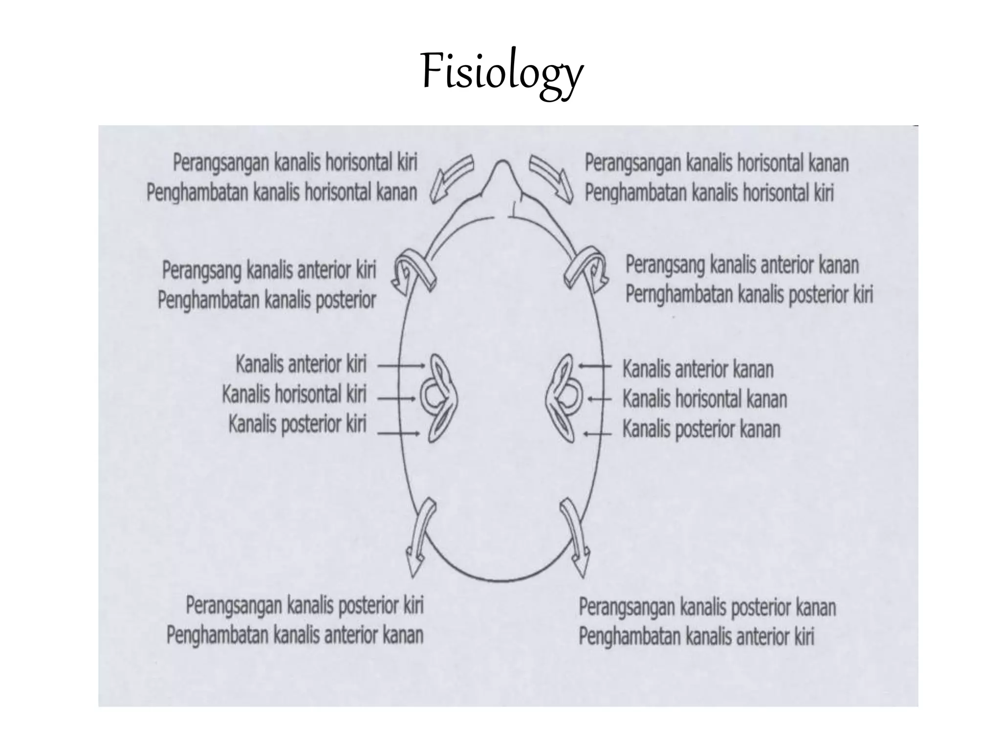 Vertigo Work up & management pptx.pptx