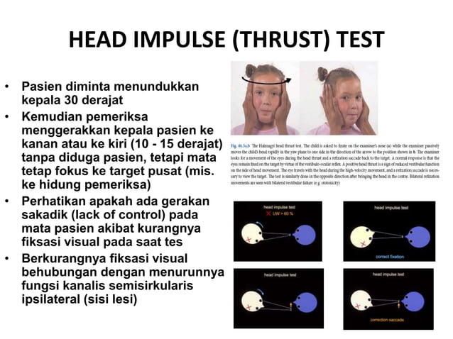 Vertigo Work up & management pptx.pptx