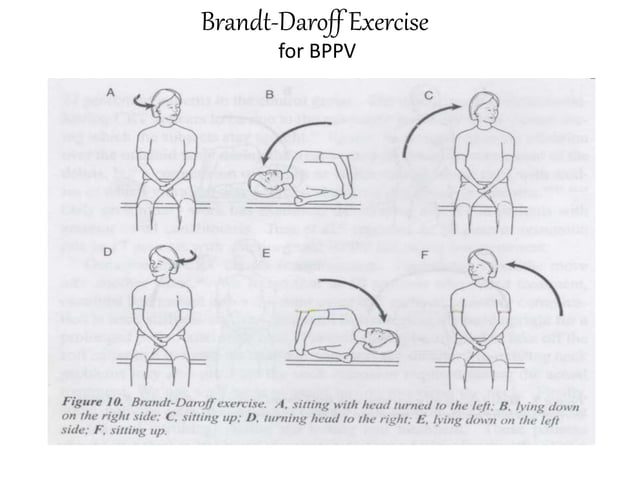 Vertigo Work up & management pptx.pptx