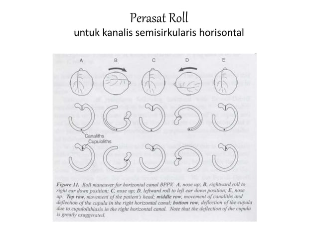 Vertigo Work up & management pptx.pptx