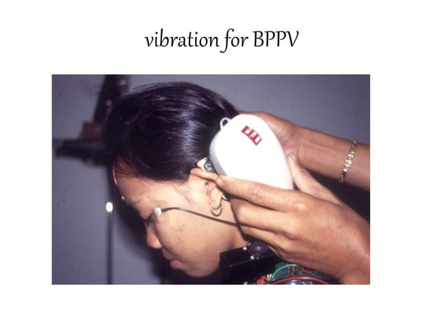 Vertigo Work up & management pptx.pptx