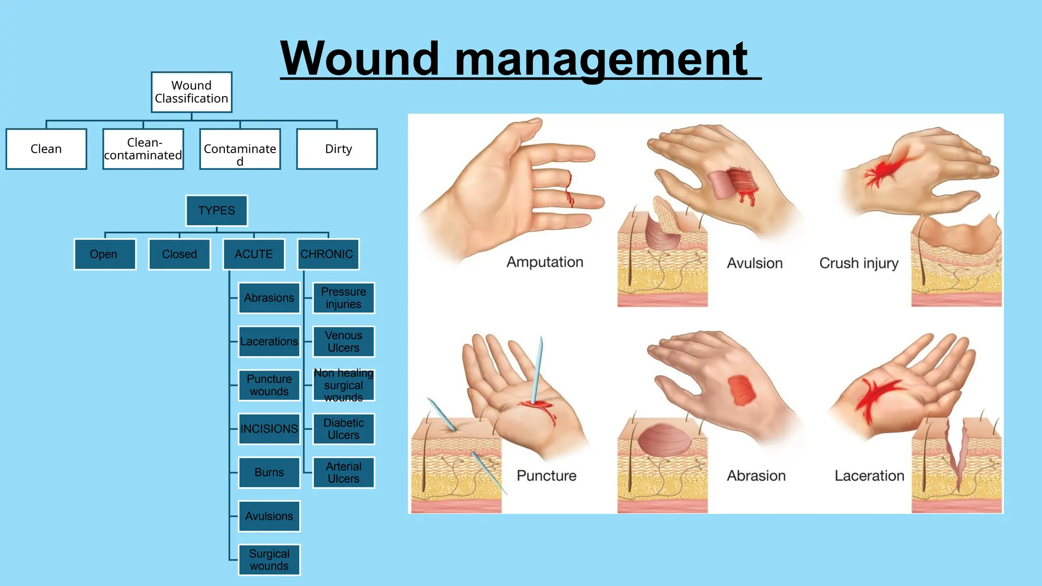 very very Basic Principles of Sutures , Wound management.pptx
