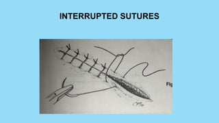 very very Basic Principles of Sutures , Wound management.pptx