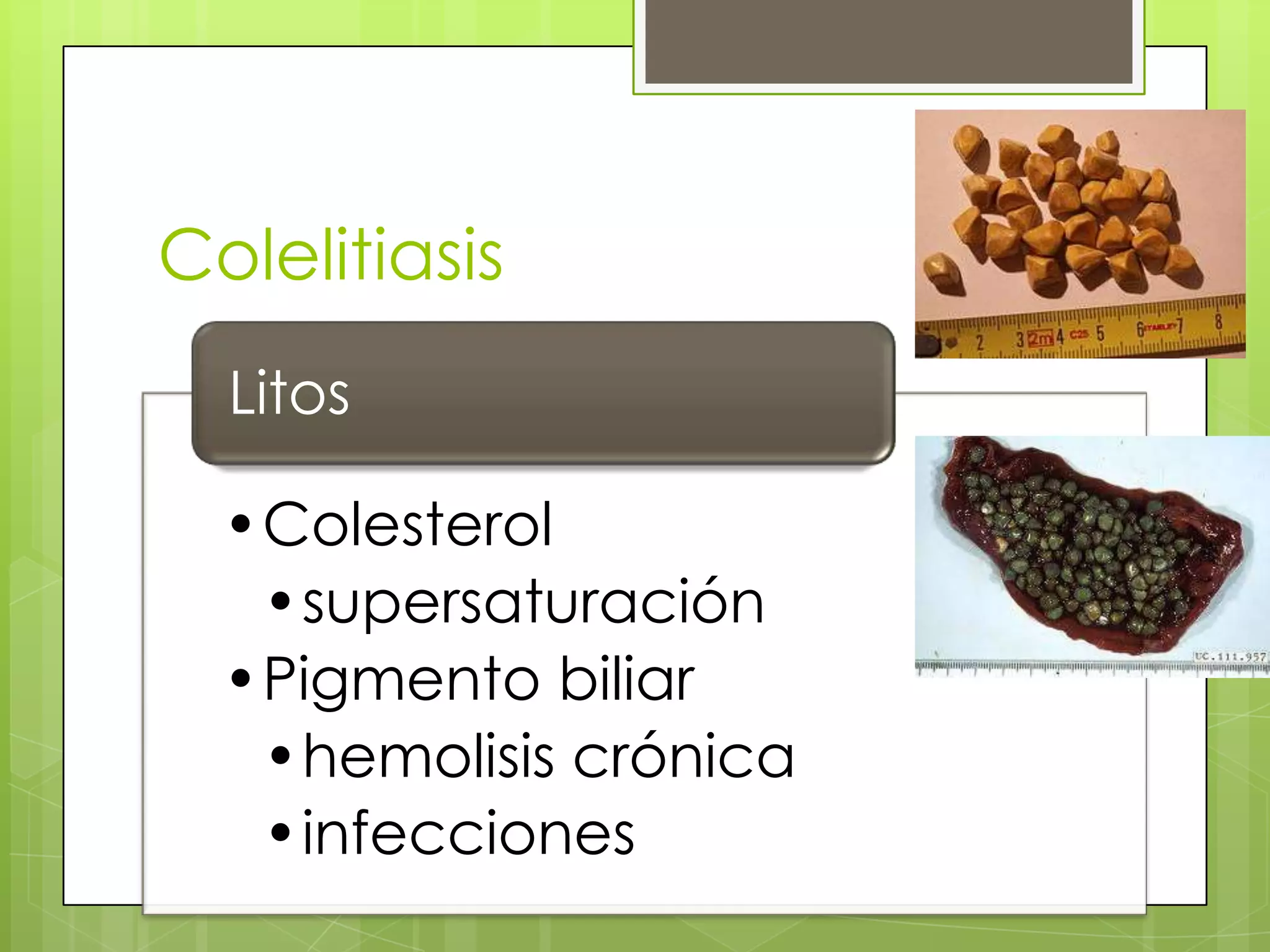 Ves biliar, colecistitis, colelitiasis | PPSX