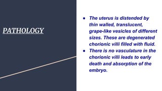 Vescicular mole.pptx