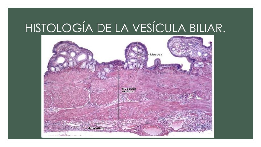 Histología de vesícula biliar y vías biliares