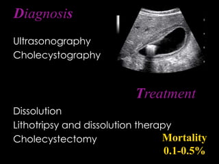 Gallbladder and biliary tract diseases | PPTX
