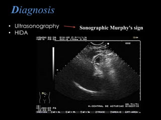 Gallbladder and biliary tract diseases | PPTX