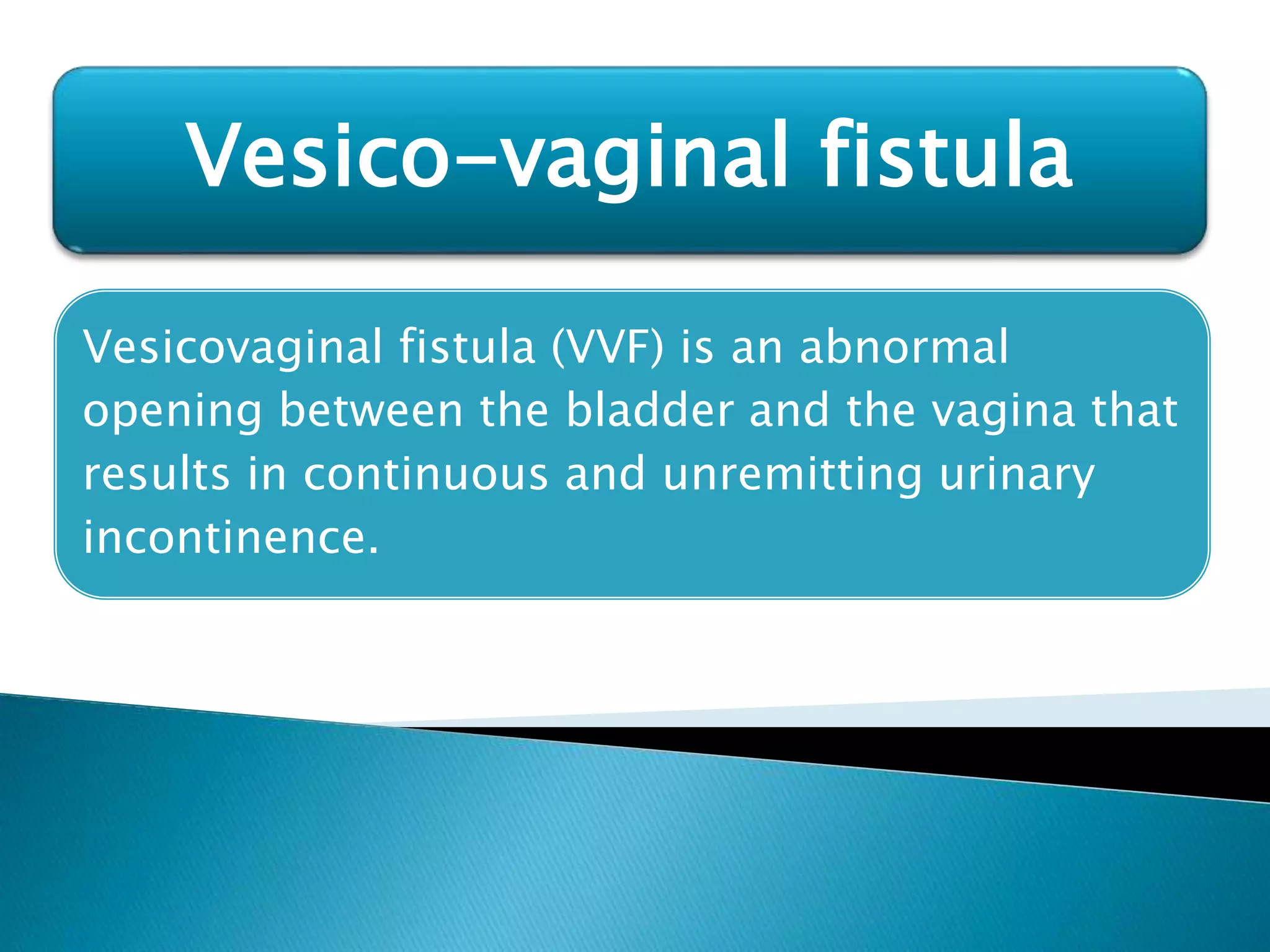 Vesico vaginal fistula | PPTX
