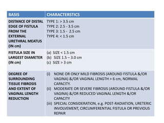 Vesico vaginal fistula | PPTX