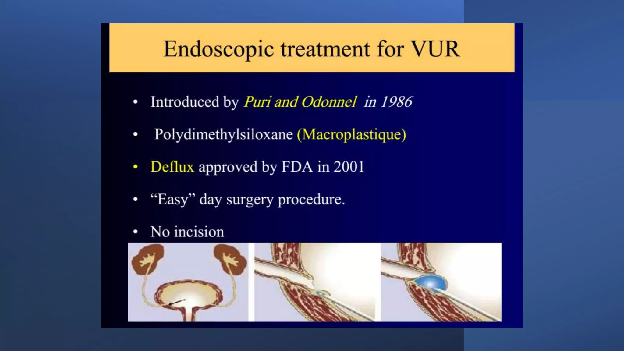 Vesicoureteral Reflux.pptx