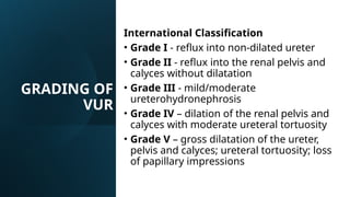 Vesicoureteral Reflux: Causes, Diagnosis, and Management | PPT