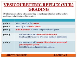 Vesico ureteric reflux | PPT