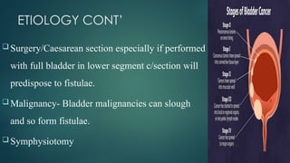vesico vaginal and vesico rectal fistulas.pptx
