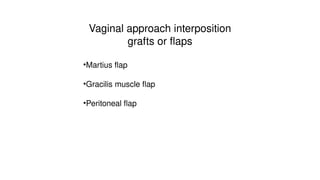 vesicovaginal fistula.pptx . | PPTX